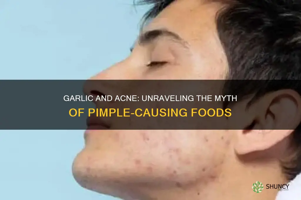 Garlic And Acne: Unraveling The Myth Of Pimple-Causing Foods | ShunCy