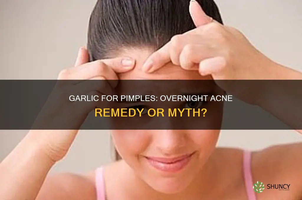 Garlic For Pimples: Overnight Acne Remedy Or Myth? | ShunCy