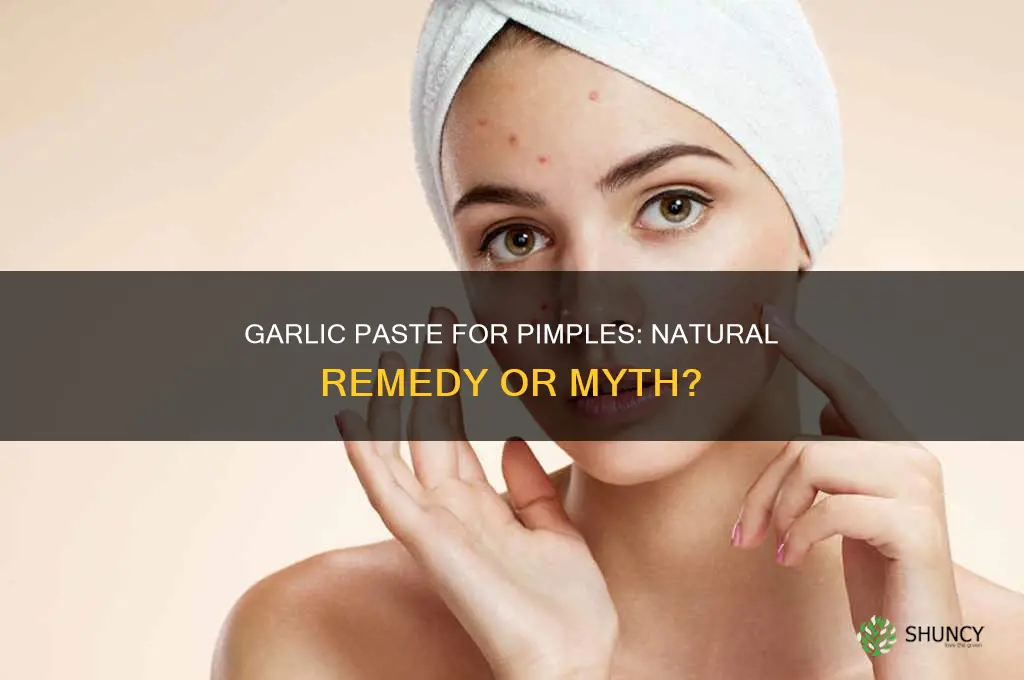 Garlic Paste For Pimples: Natural Remedy Or Myth? | ShunCy