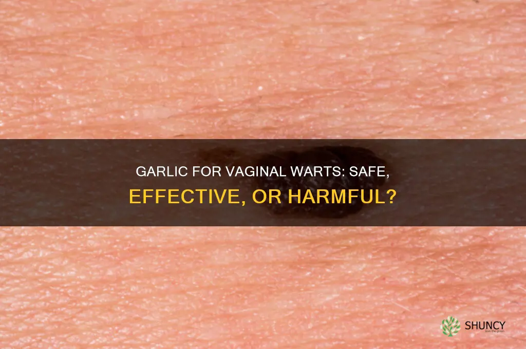 Garlic For Vaginal Warts: Safe, Effective, Or Harmful? | ShunCy