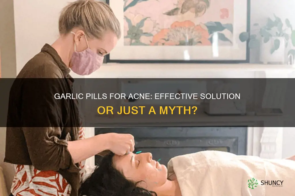 Garlic Pills For Acne: Effective Solution Or Just A Myth? | ShunCy