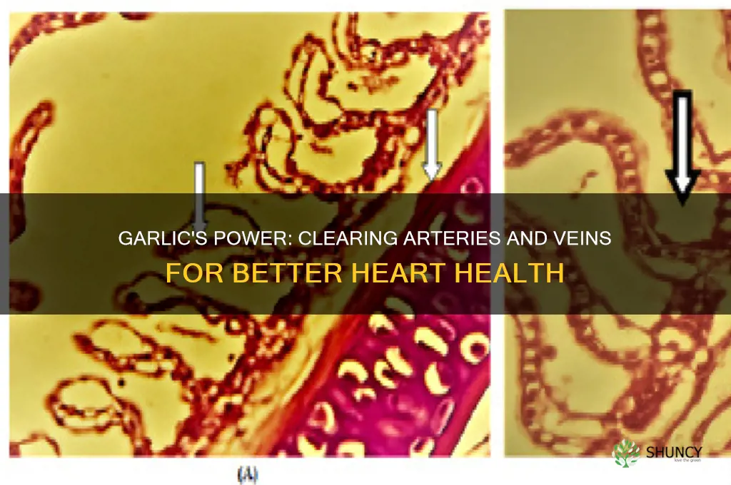Garlic's Power: Clearing Arteries And Veins For Better Heart Health ...