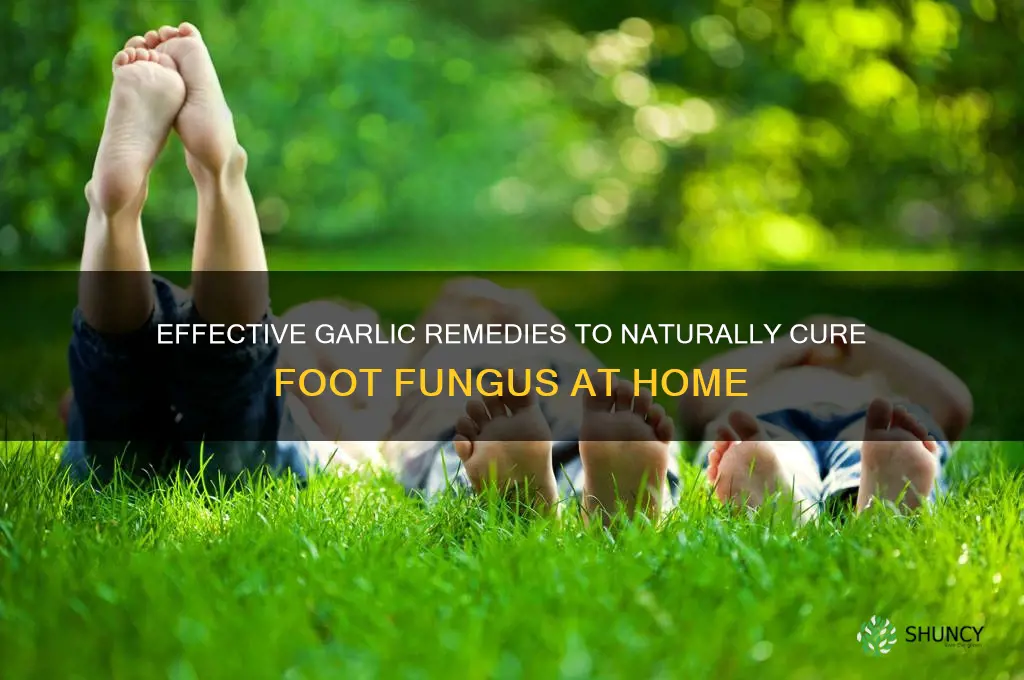 Effective Garlic Remedies To Naturally Cure Foot Fungus At Home | ShunCy