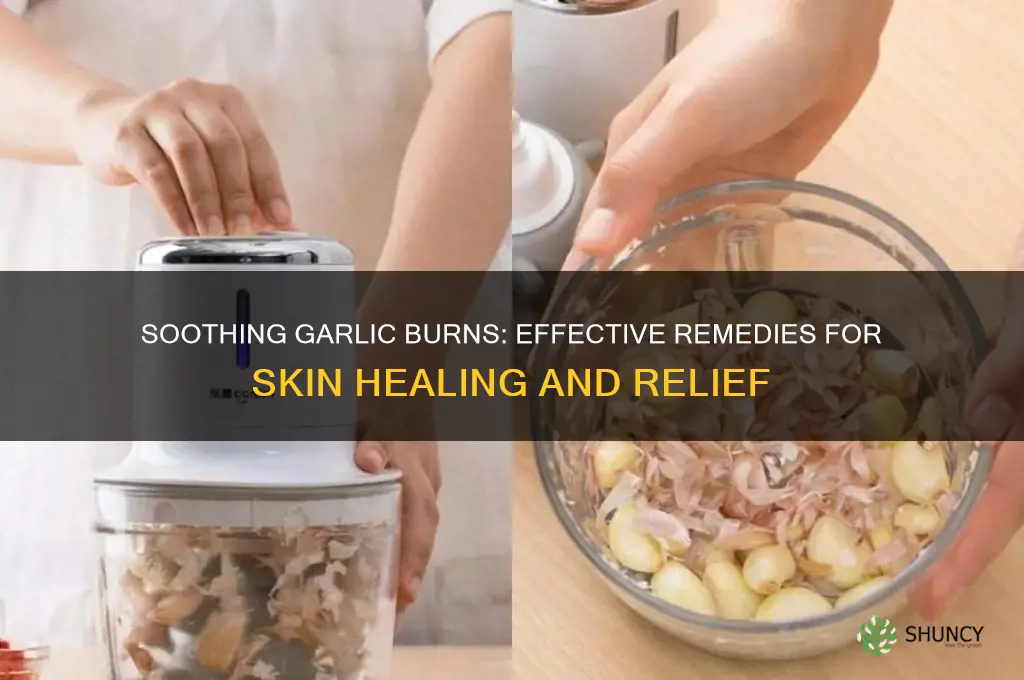 Soothing Garlic Burns: Effective Remedies For Skin Healing And Relief ...