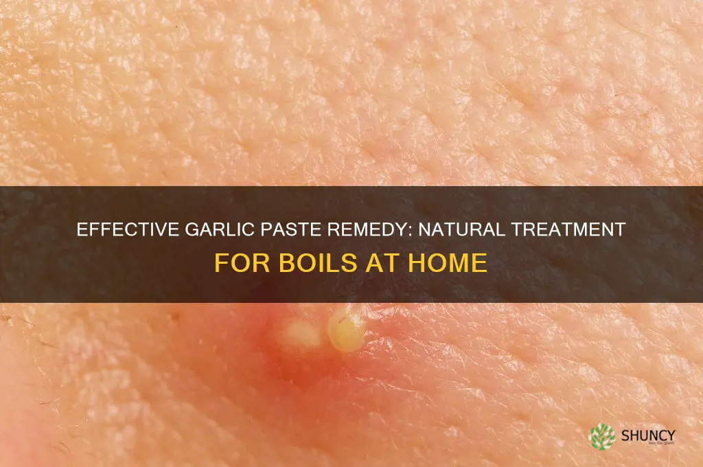 Effective Garlic Paste Remedy: Natural Treatment For Boils At Home | ShunCy