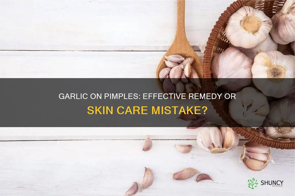 Garlic On Pimples: Effective Remedy Or Skin Care Mistake? | ShunCy